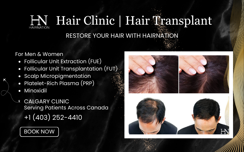 Best Hair Loss Clinic | Hair Transplant | FUE | FUT | Calgary, Canada