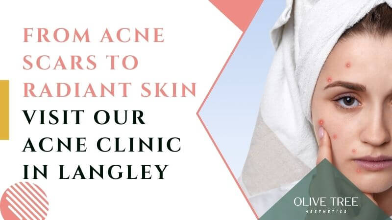 FROM ACNE SCARS TO RADIANT SKIN VISIT OUR ACNE CLINIC IN LANGLEY, BC